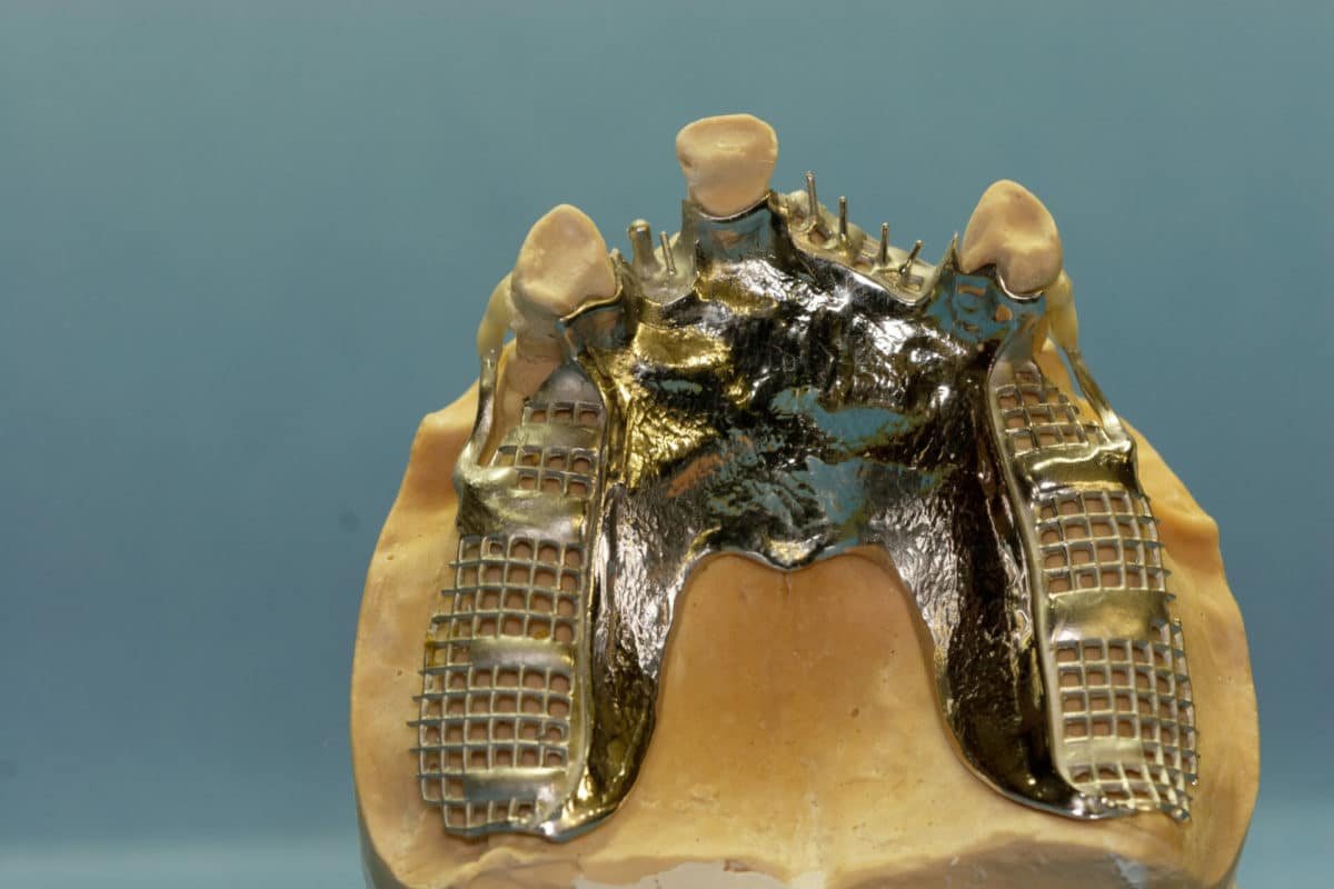 Les métiers de la prothèse dentaire - %sitename%-1